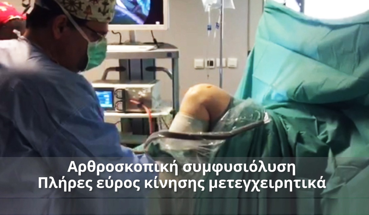 Αρθροσκοπική Αντιμετώπιση Δυσκαμψίας μετά από Αρθροπλαστική Γόνατος ...